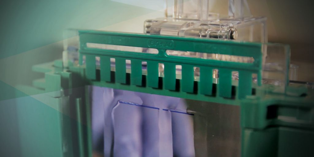 tgx-stain-free-fastcast-acrylamide-gel-casting-feature | Bioradiations